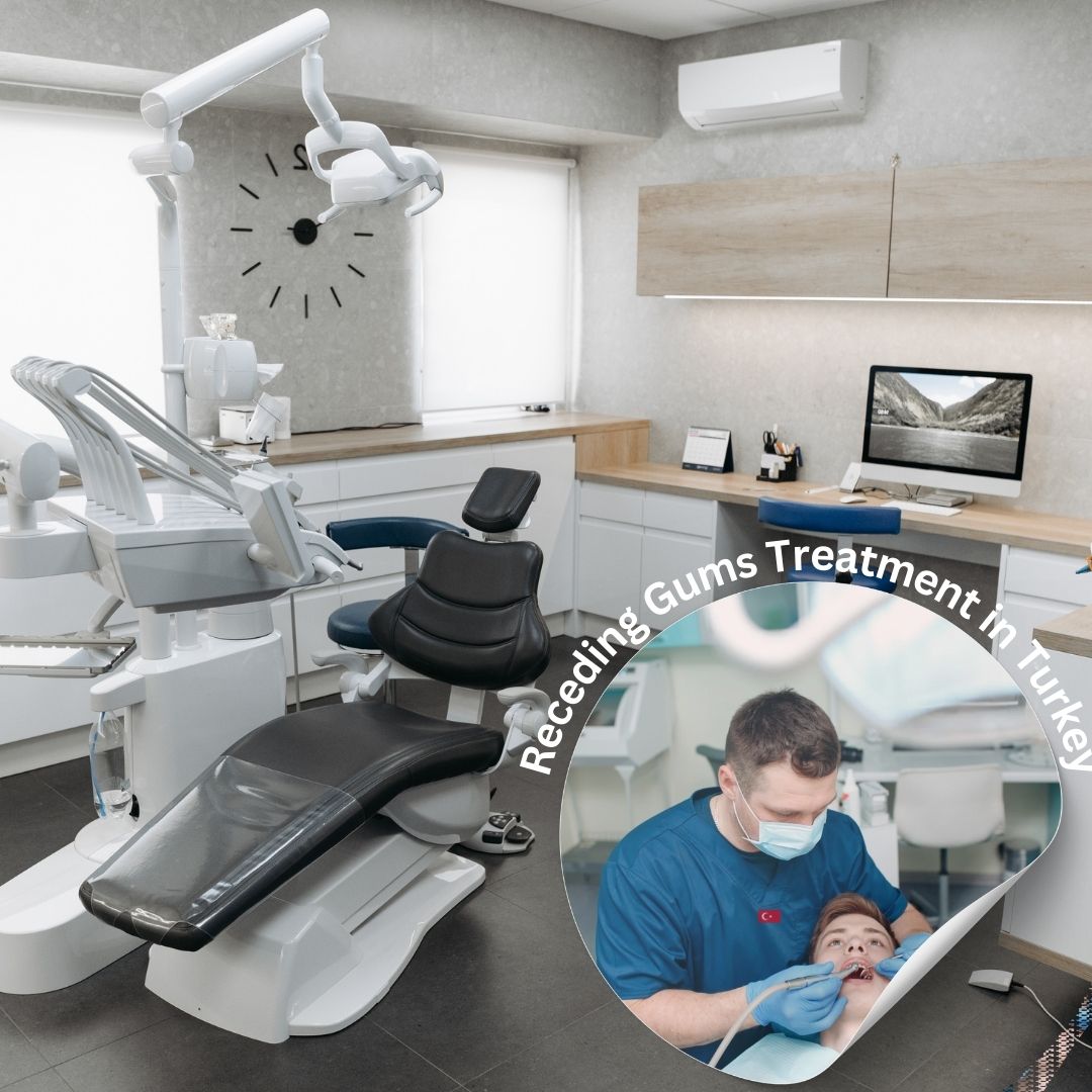 Receding Gums Causes and Treatment