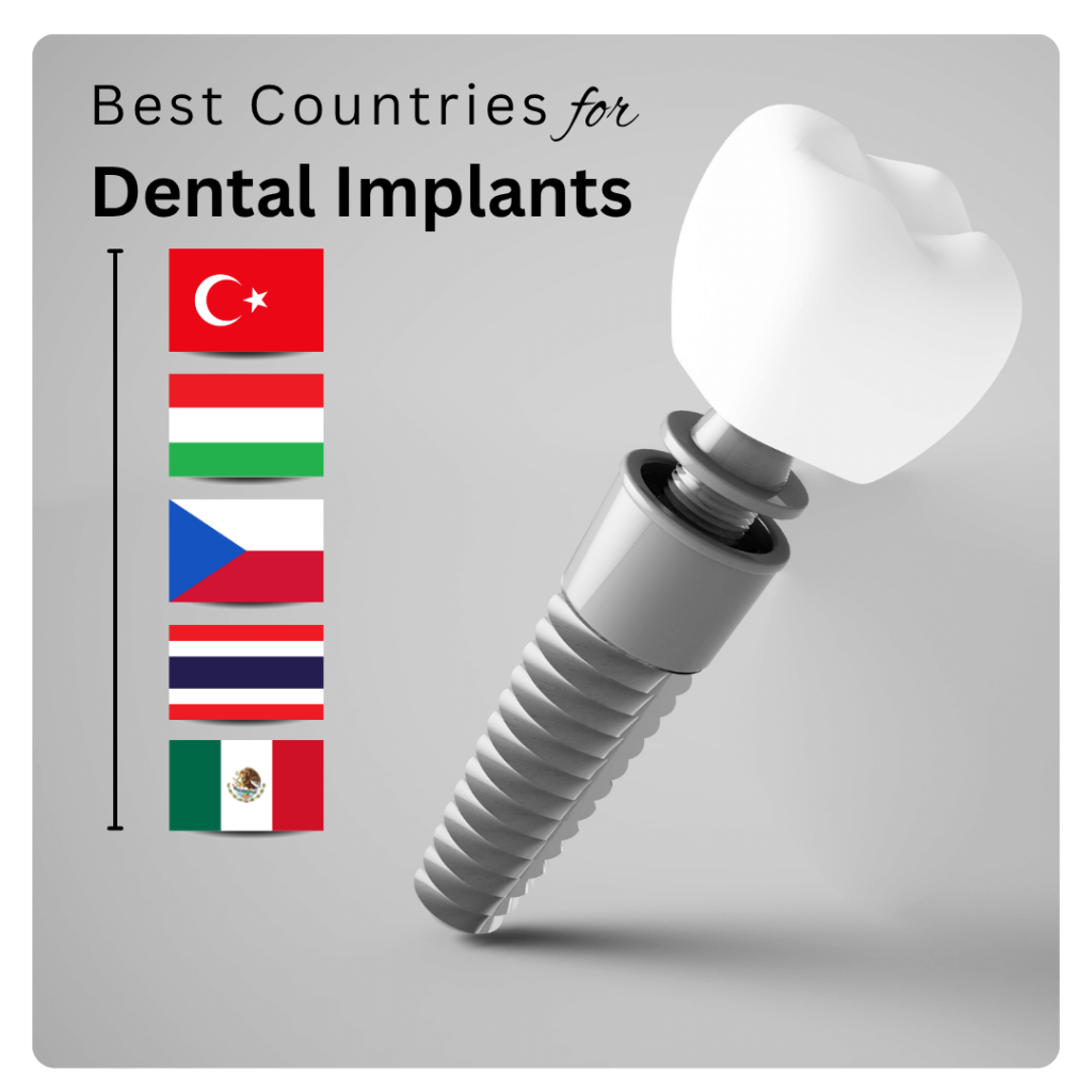 Best Countries for Dental Implants - Darya Dental Clinic